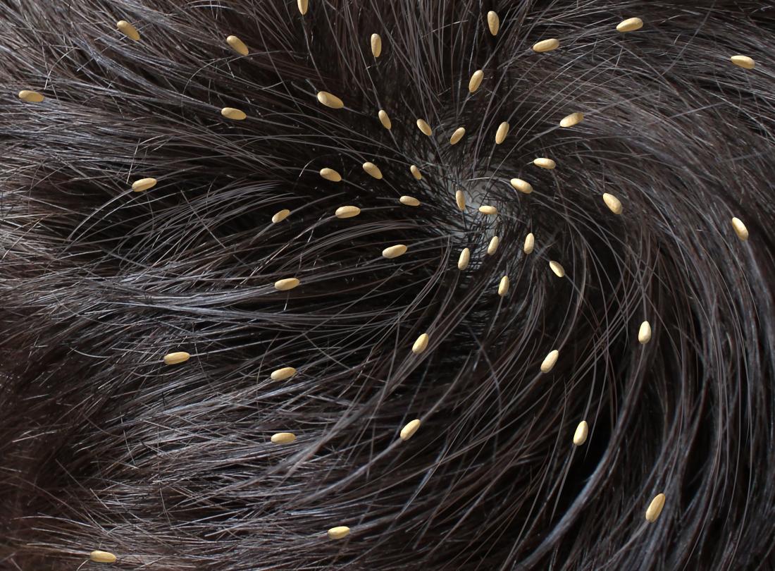 Human Louse Hair Human Louse Hair