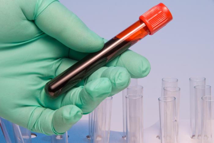 Sickle cell trait and disease: raising awareness