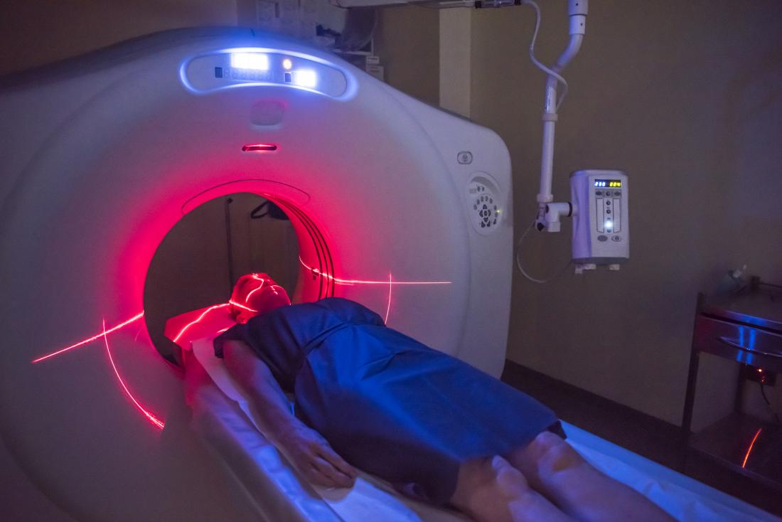 Dementia Amyloid PET Scans Can Improve Diagnosis And Care Dementia Amyloid PET Scans Can Improve Diagnosis And Care