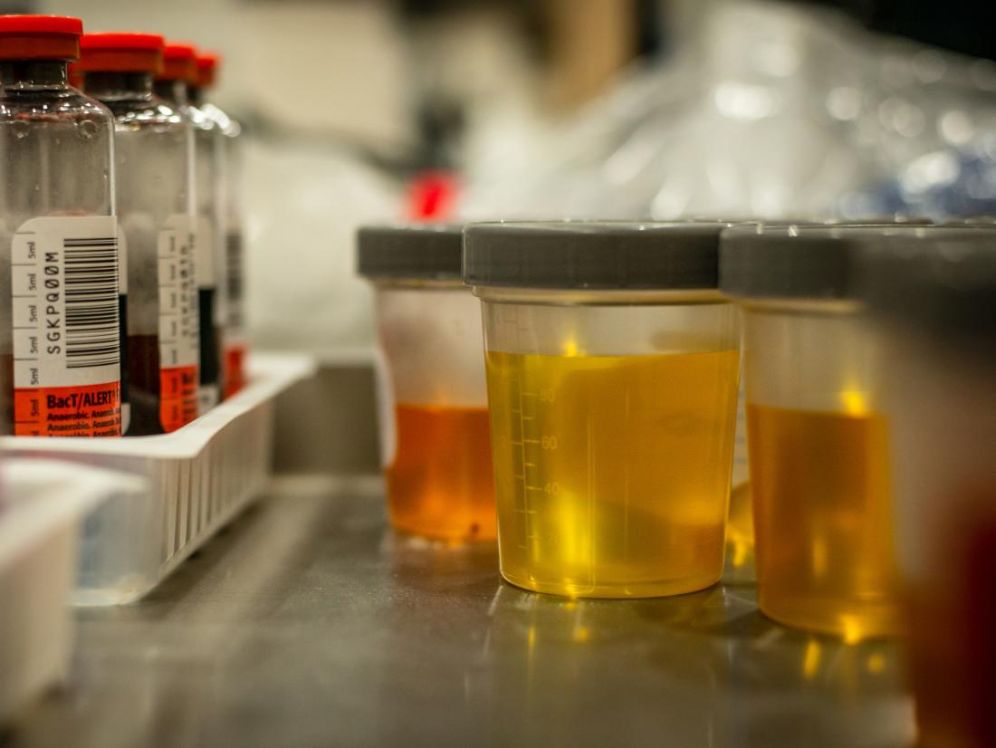 Urinalysis Test Urine Test Strips Mission 11 Parameter Urinalysis
