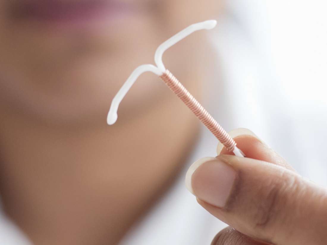 IUD Removal When To Remove An IUD And What To Expect
