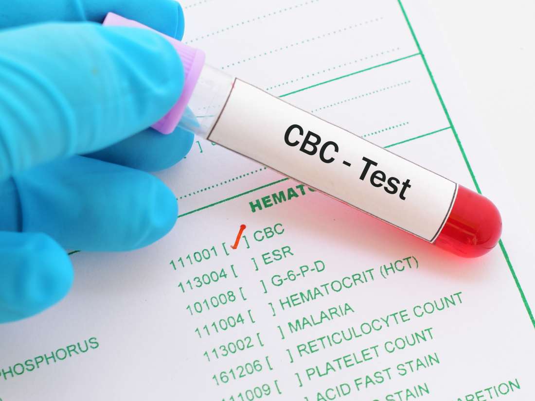 High MCHC Causes Treatment And Symptoms