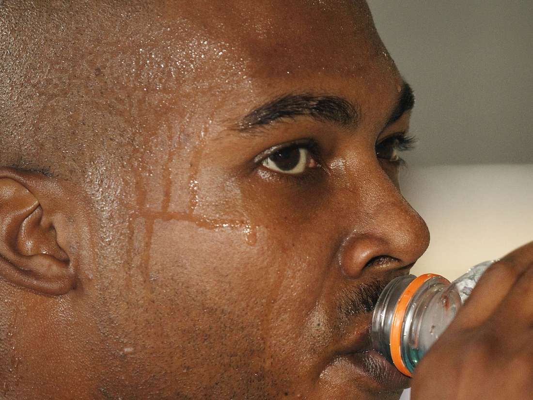 Diaphoresis Causes Treatment And Prevention Diaphoresis Causes Treatment And Prevention
